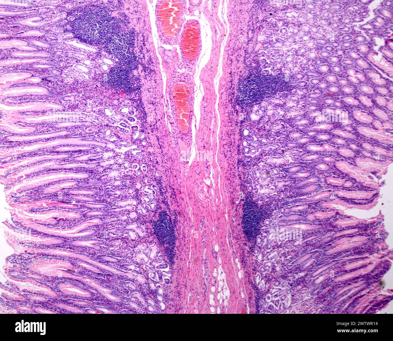Light micrograph of the fold of the gastric wall showing the mucosa of ...