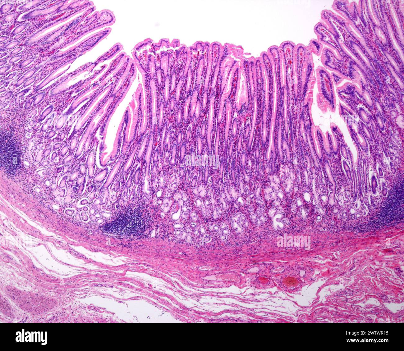 Light micrograph if the mucosa of the stomach in the region of the ...