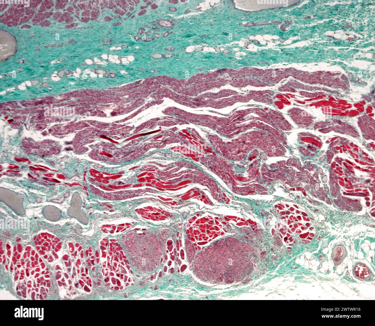 Light micrograph of the muscular layer of the esophagus. This layer is ...