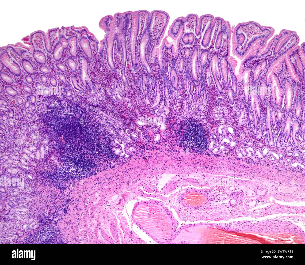 Light micrograph if the mucosa of the stomach in the region of the ...