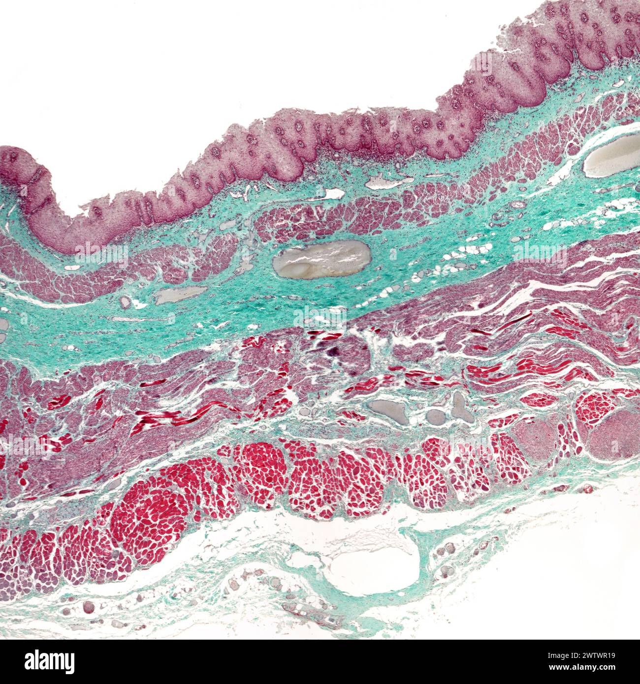 Light micrograph of a human oesophagus showing, from top, mucosa lined ...