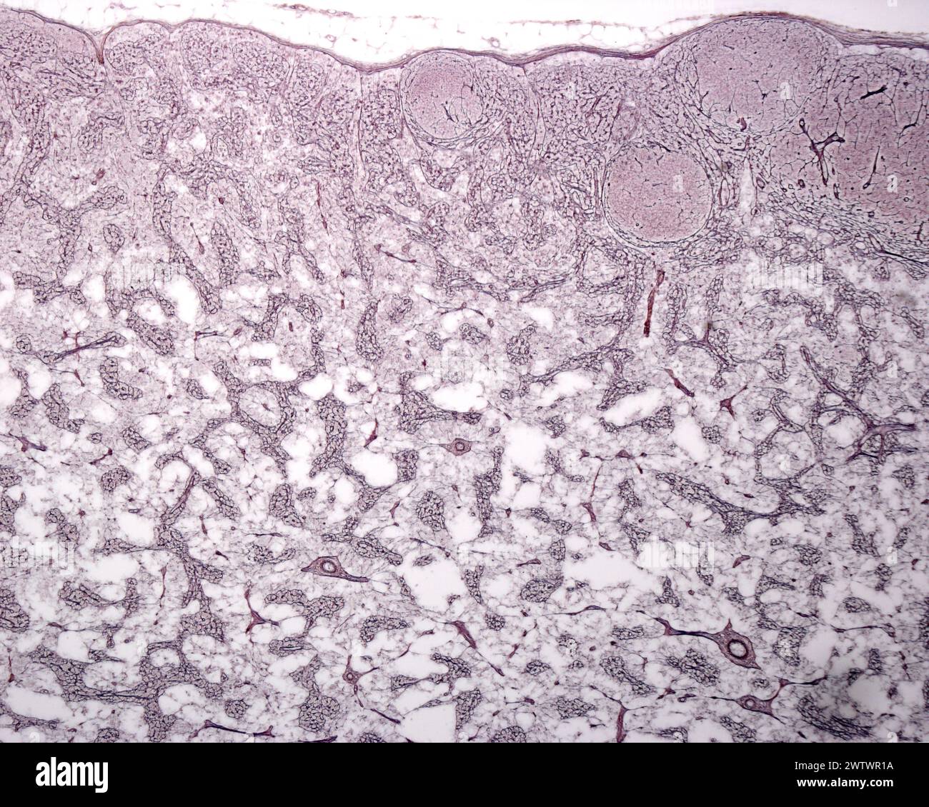 Light micrograph of a lymph node stained with a silver technique for ...