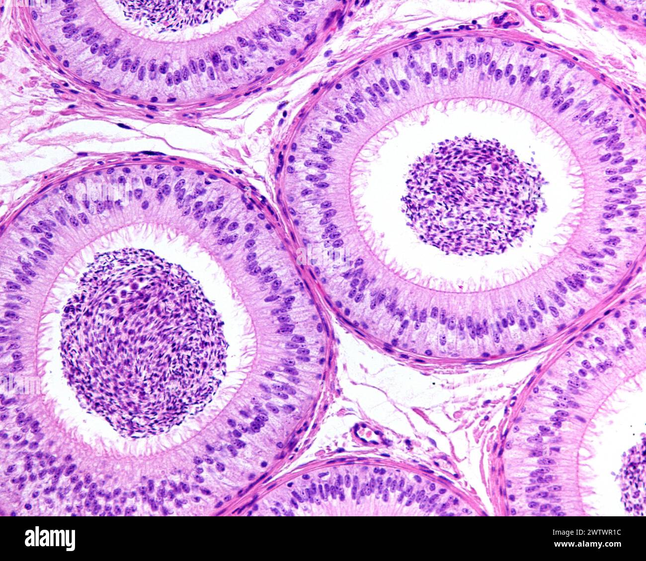 Light micrograph of epididymal ducts lined by pseudostratified ...