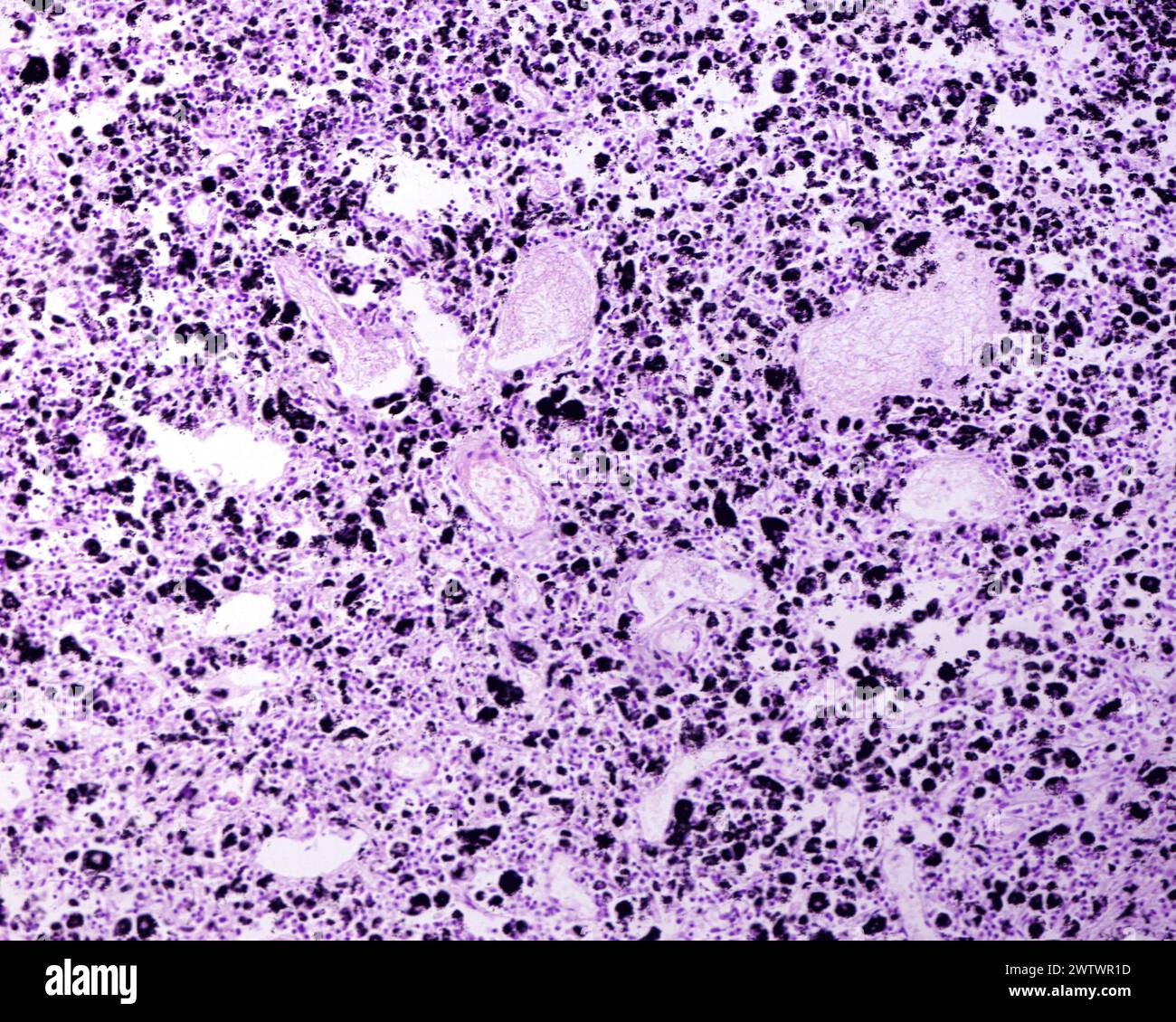 Light micrograph of a human lymph node located near the hilus of an ...