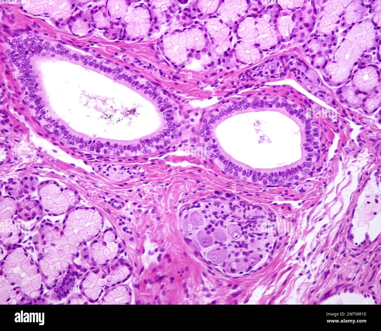 Human sublingual gland. Light micrograph showing an interlobular ...