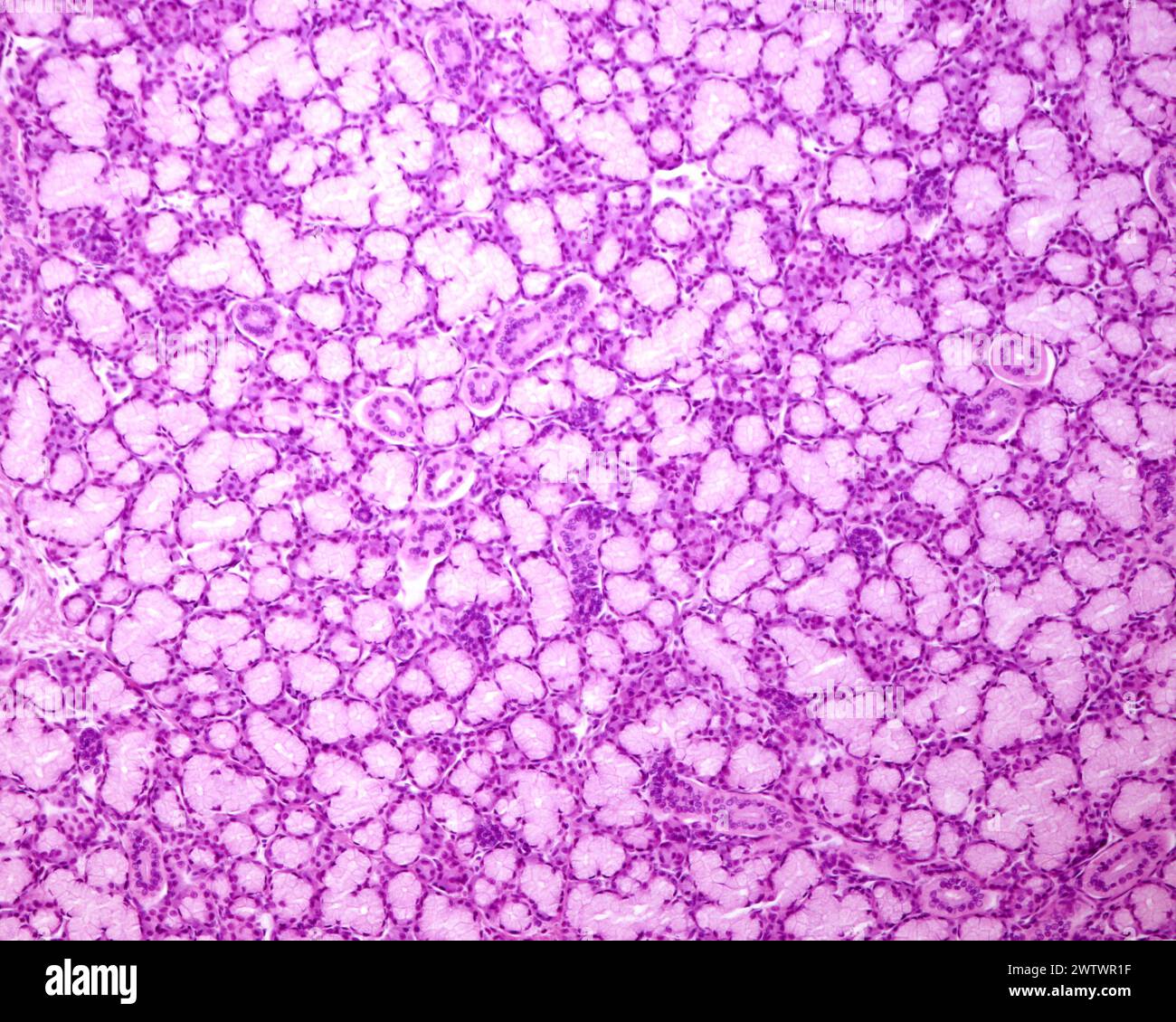 Human sublingual gland, light micrograph. The sublingual gland is a ...