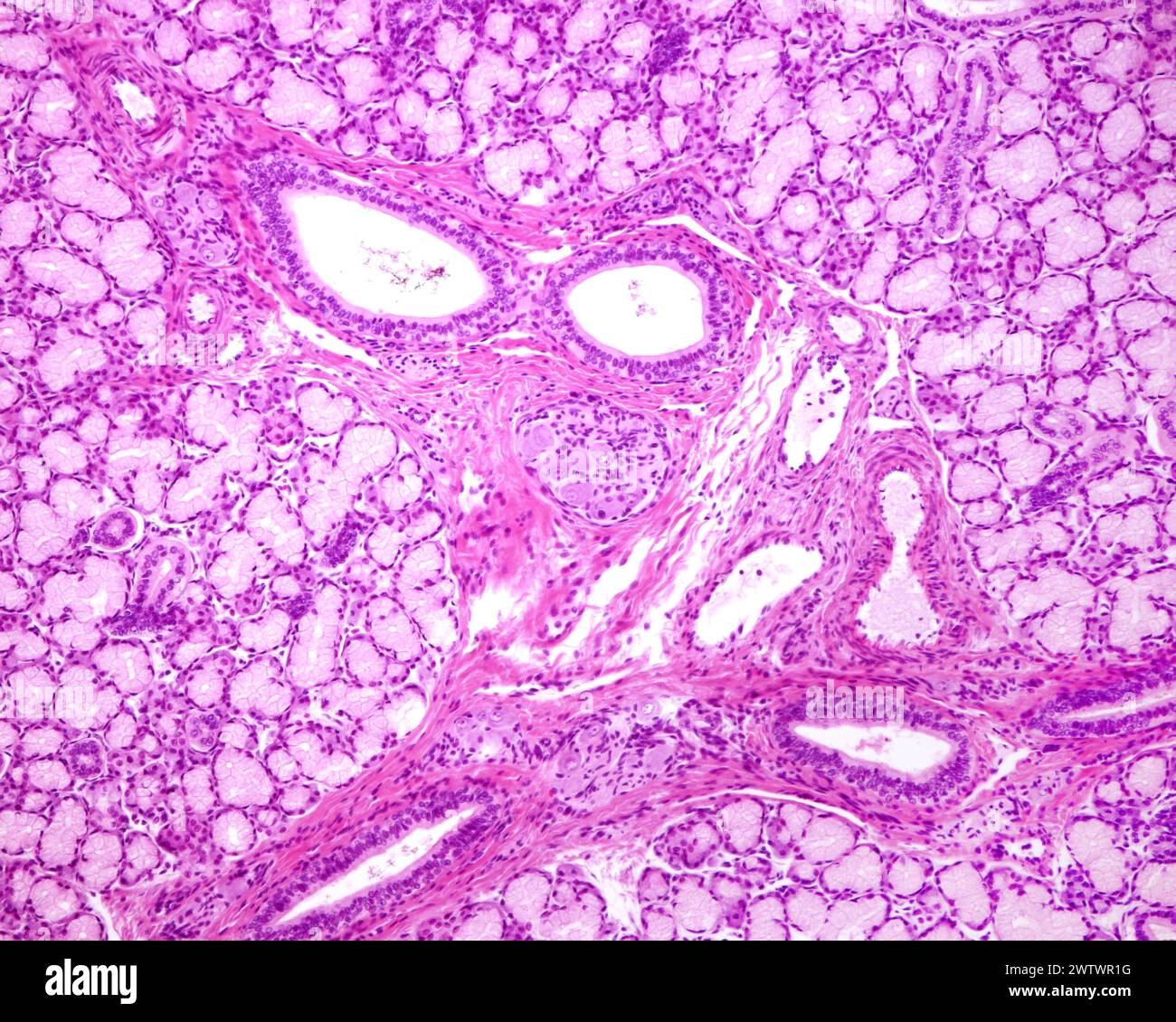 Human Sublingual Gland Light Micrograph The Sublingual Gland Is A