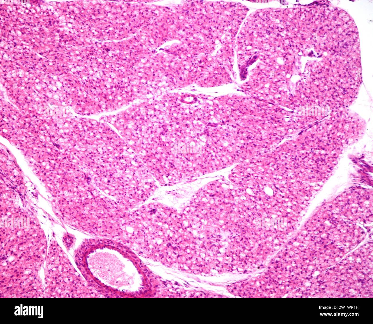 Light micrograph showing interscapular brown adipose (fat) tissue ...