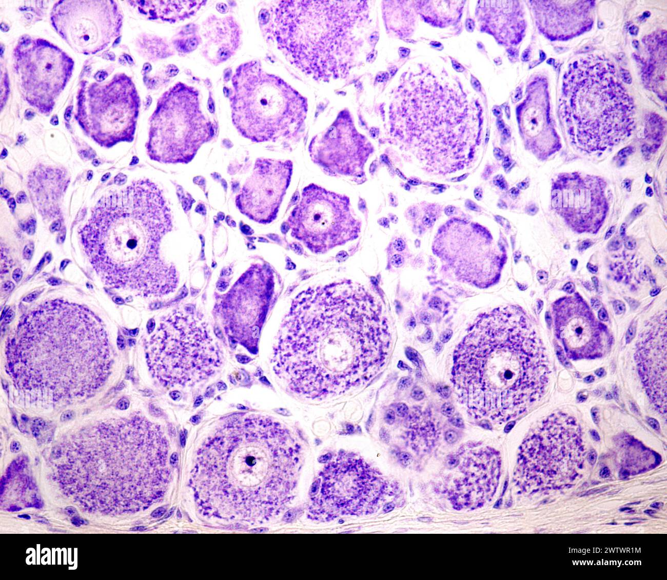 Light micrograph showing neurons (nerve cells) in a dorsal root ...