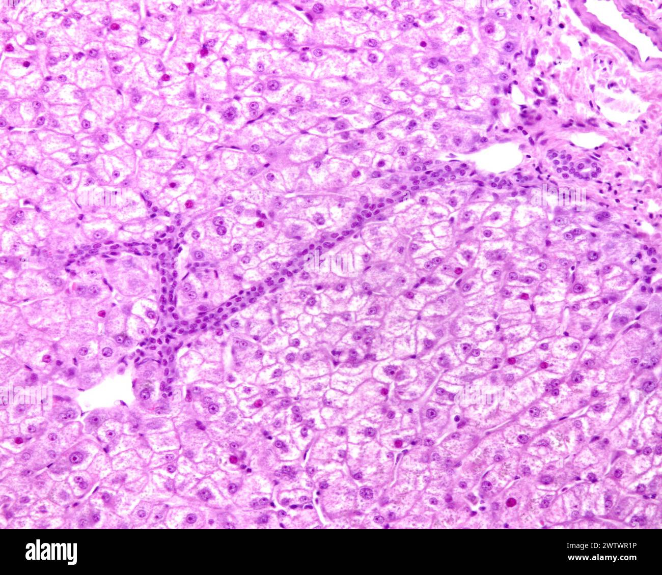Light micrograph of a canal of Hering, or intrahepatic bile ductule, in ...
