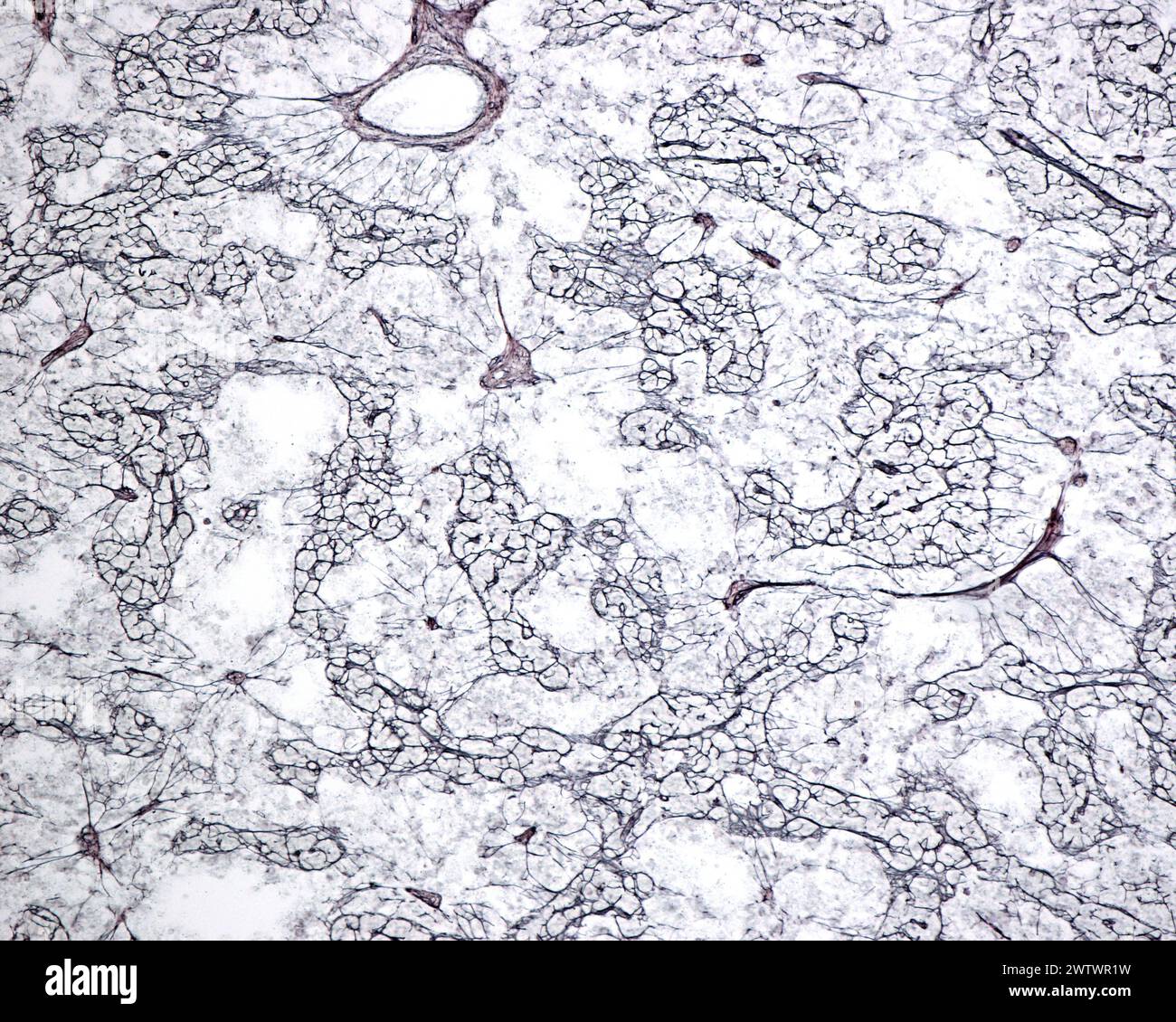 Light micrograph of a lymph node medulla stained with a silver ...