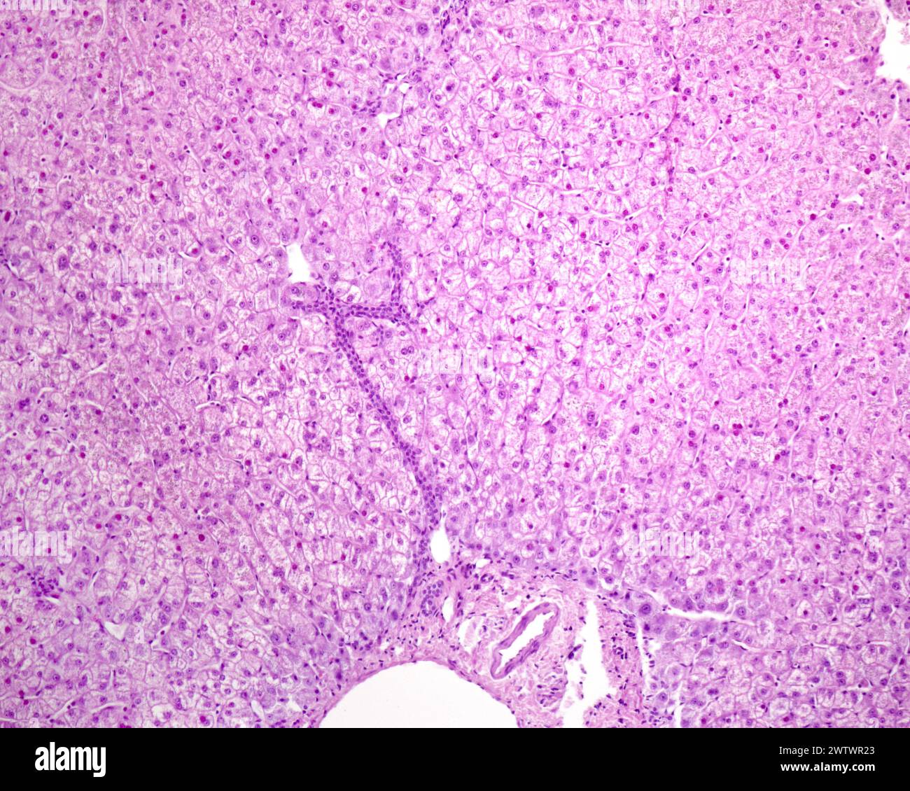 Light micrograph of a canal of Hering, or intrahepatic bile ductule, in ...