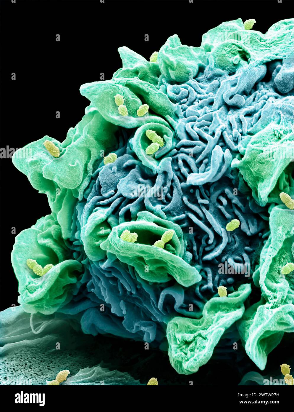 Macrophage engulfing streptococcus bacteria. Coloured composition ... Macrophage engulfing streptococcus bacteria. Coloured composition ...