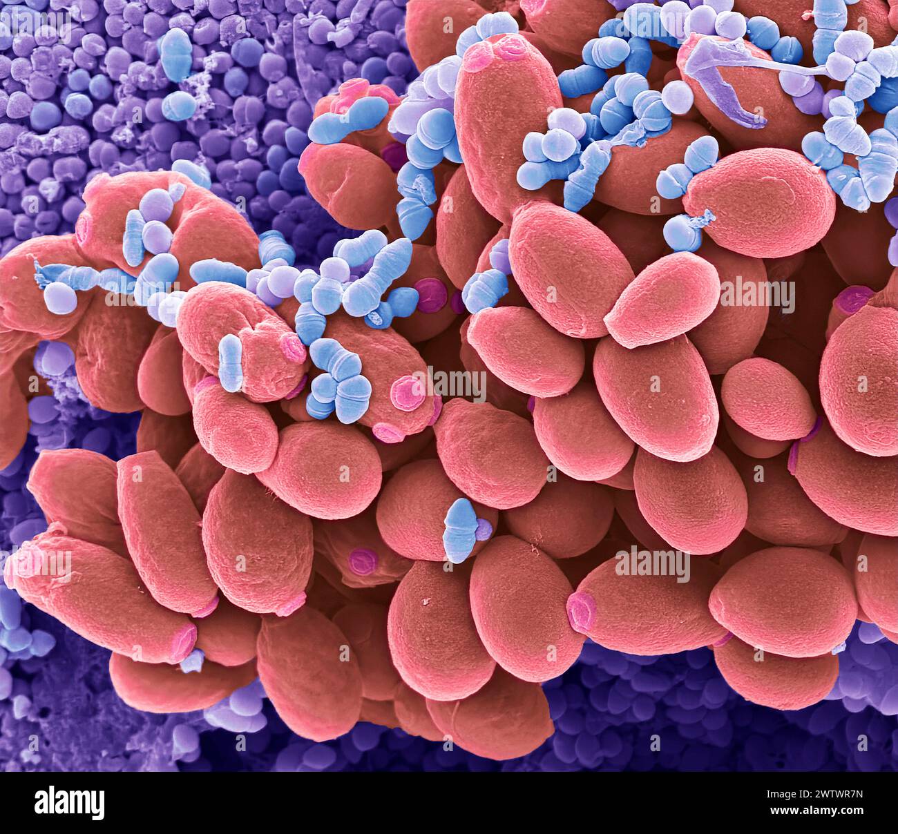 Yeast in a faecal culture. Scanning electron micrograph (SEM) of ...