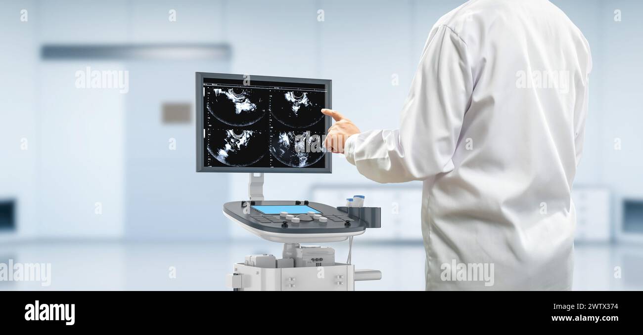 3d ultrasound hi-res stock photography and images - Alamy