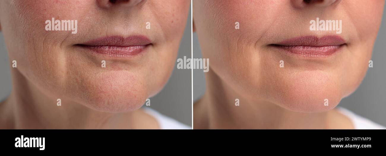 Aging skin changes. Collage with photos of mature woman before and ...