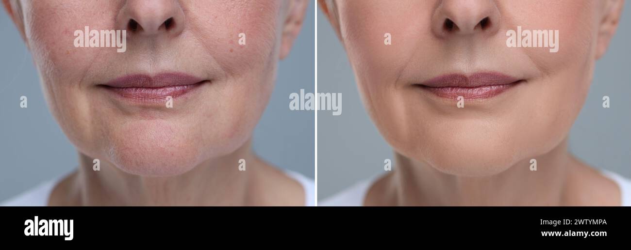 Aging skin changes. Collage with photos of mature woman before and ...