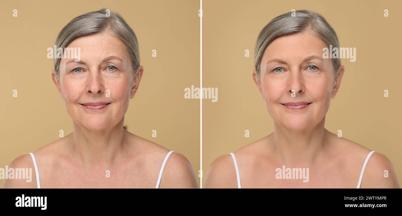 Aging skin changes. Collage with photos of mature woman before and ...