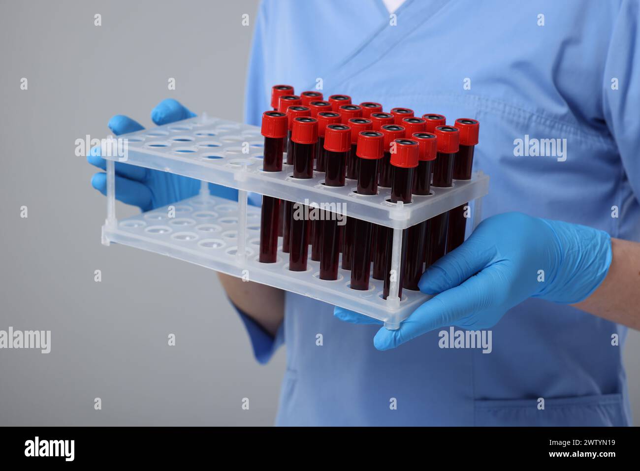 Laboratory testing. Doctor with blood samples in tubes on light grey ...