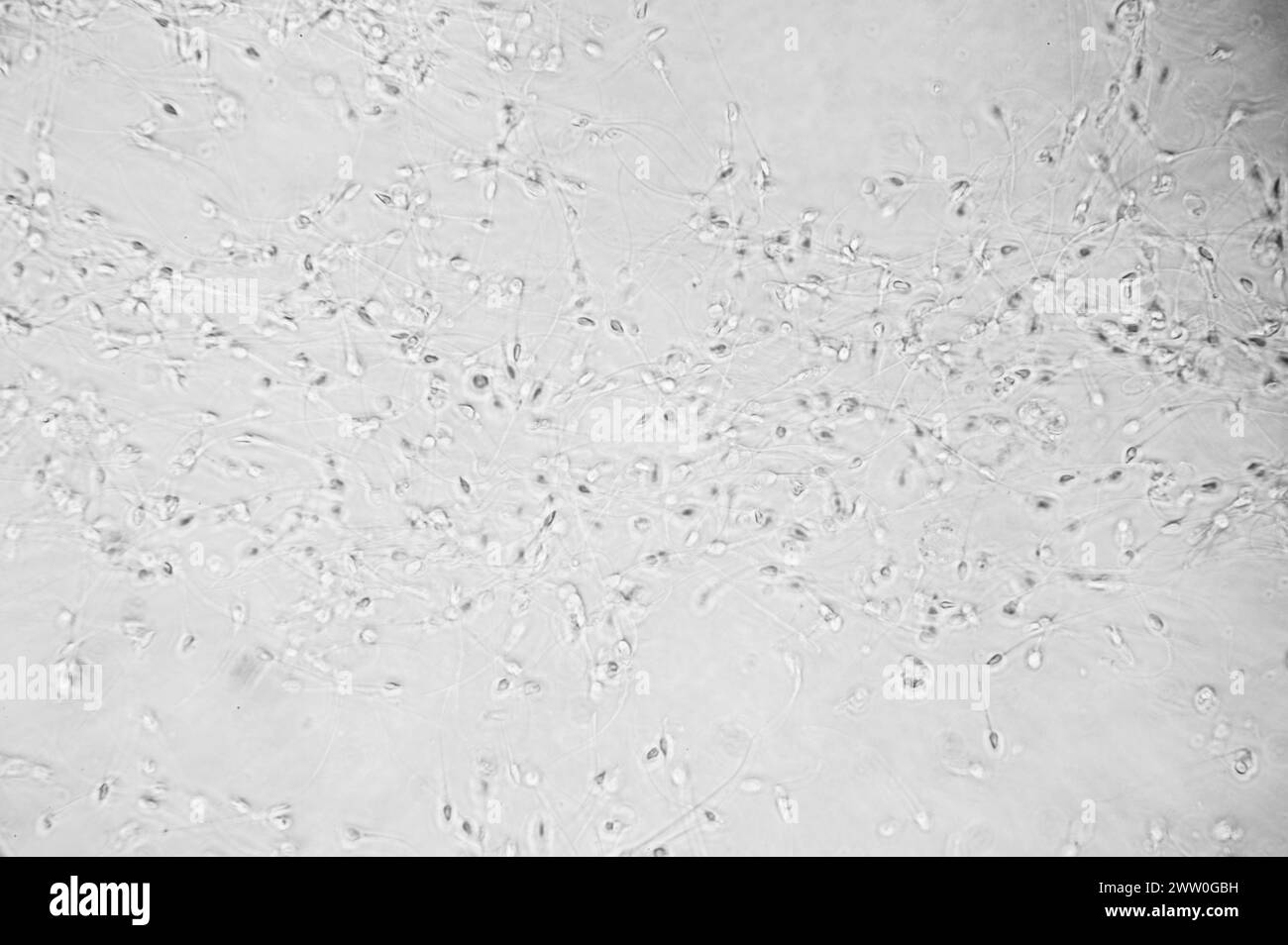 Human sperm microscope hi-res stock photography and images - Alamy