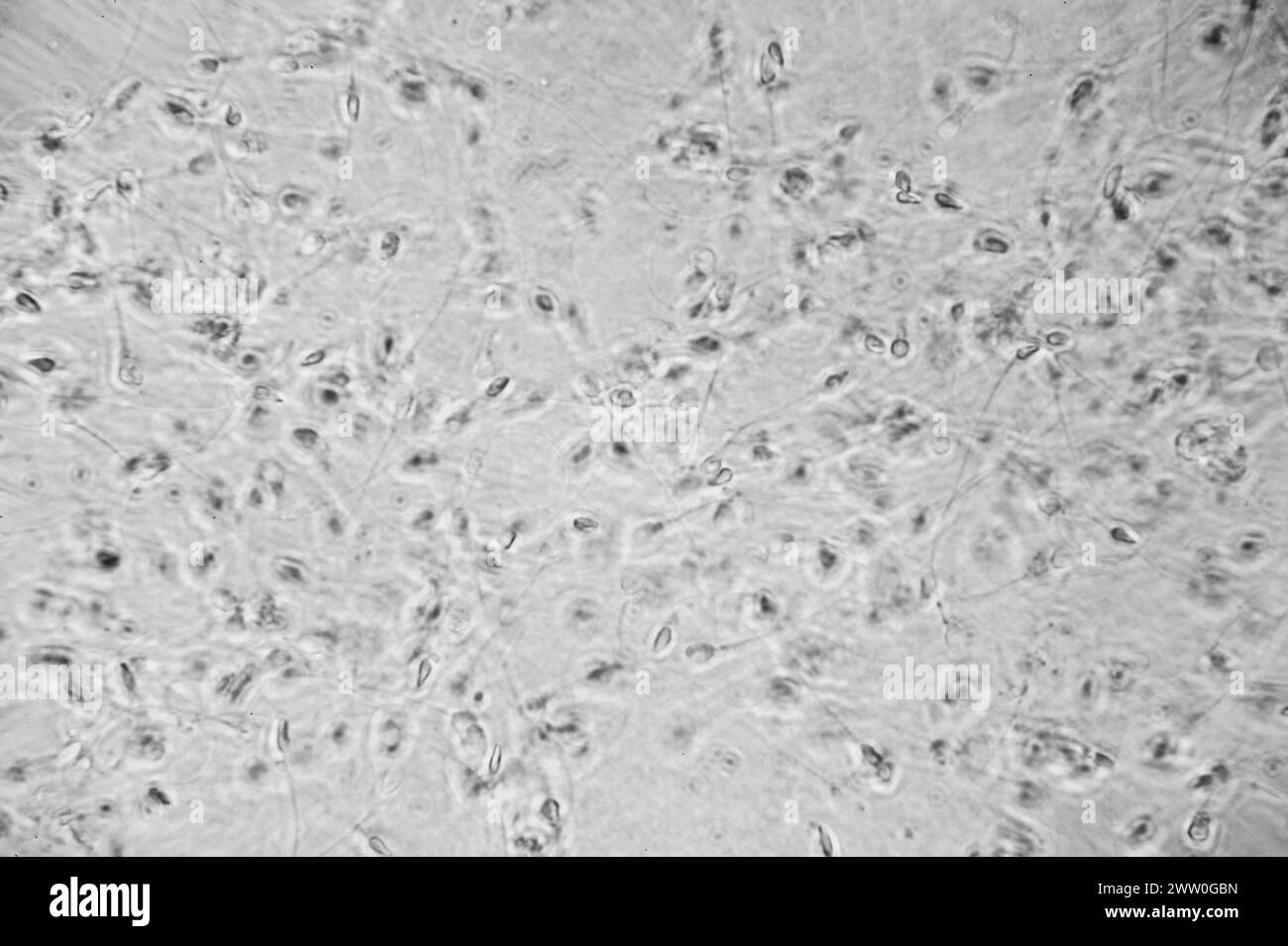 Human sperm cells Stock Photo - Alamy