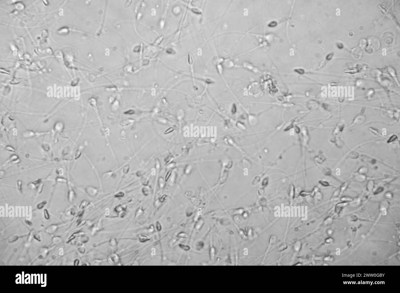 Sperm Cell Under Light Microscope Biallelic Mutations Of CFAP251 Cause