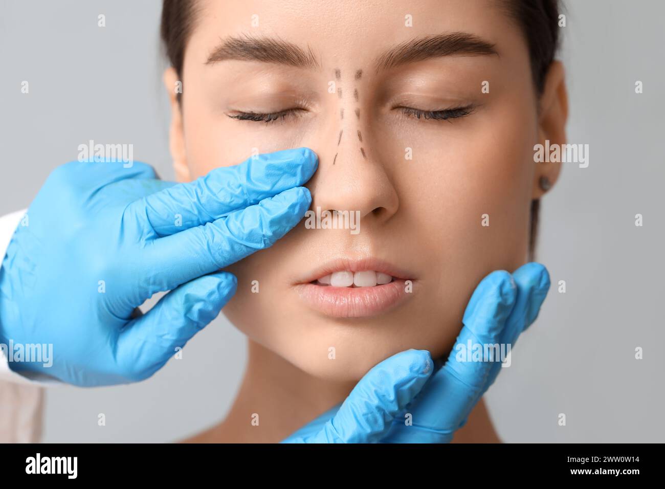 Surgeon hands touching woman nose before plastic surgery on white ...
