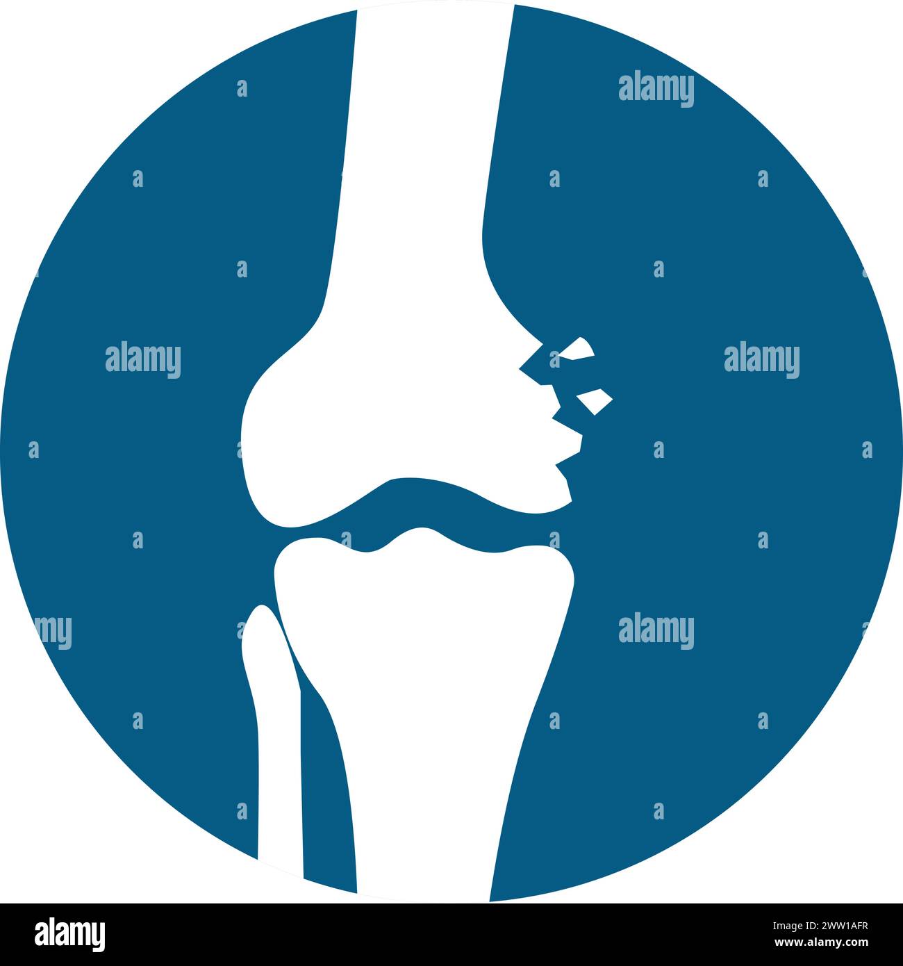 Bone fracture icon. Orthopedic injury medical symbol Stock Vector Image ...