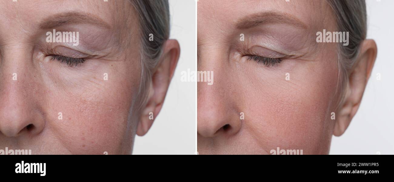 Aging skin changes. Collage with photos of mature woman before and ...