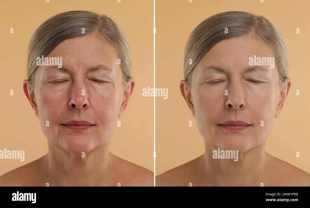 Aging skin changes. Collage with photos of mature woman before and ...