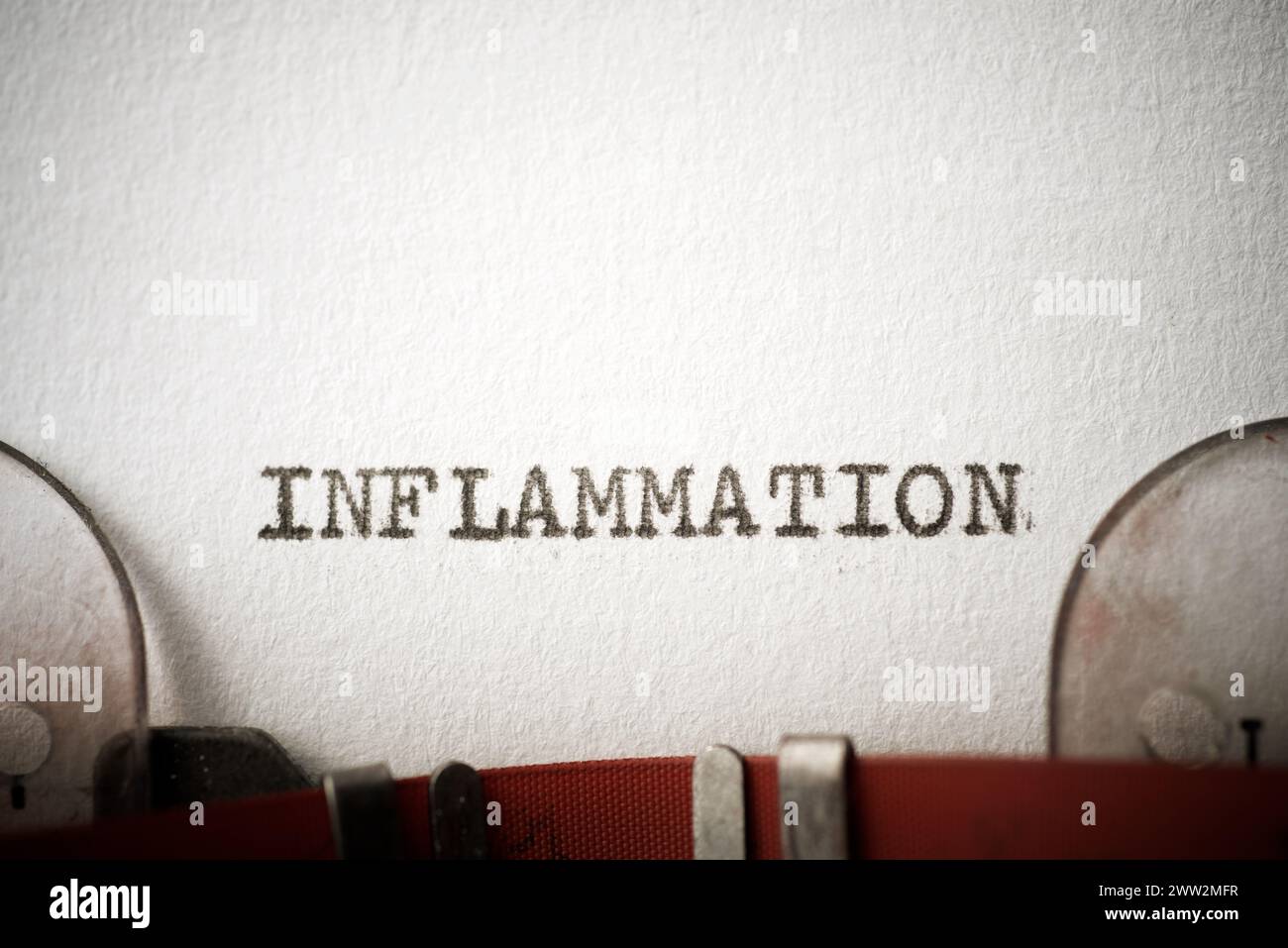 Inflammation word written with a typewriter Stock Photo - Alamy