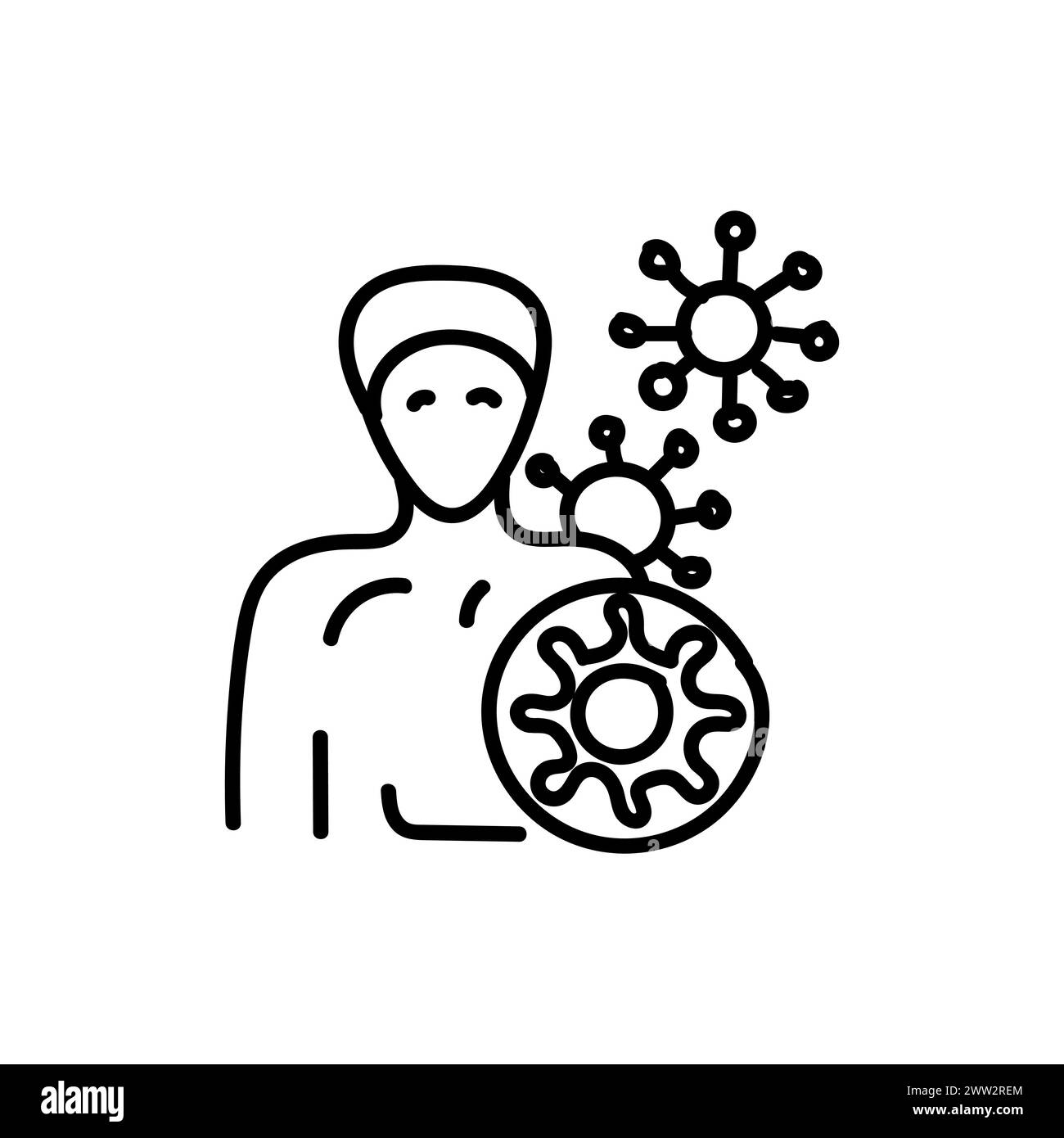 Pigmentation disease Cut Out Stock Images & Pictures - Alamy