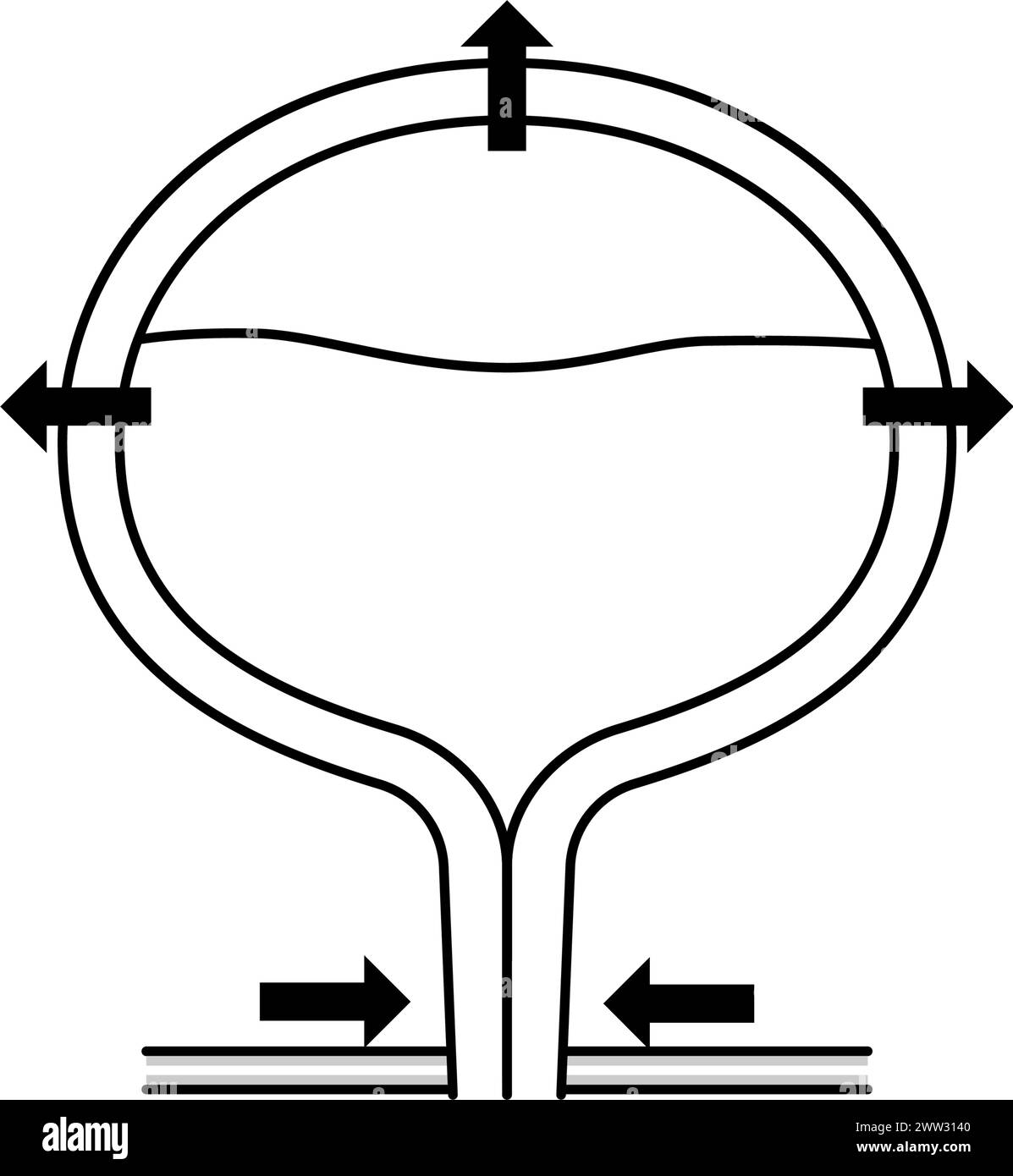 Medical illustration of the normal bladder, how it urinates, and how it ...