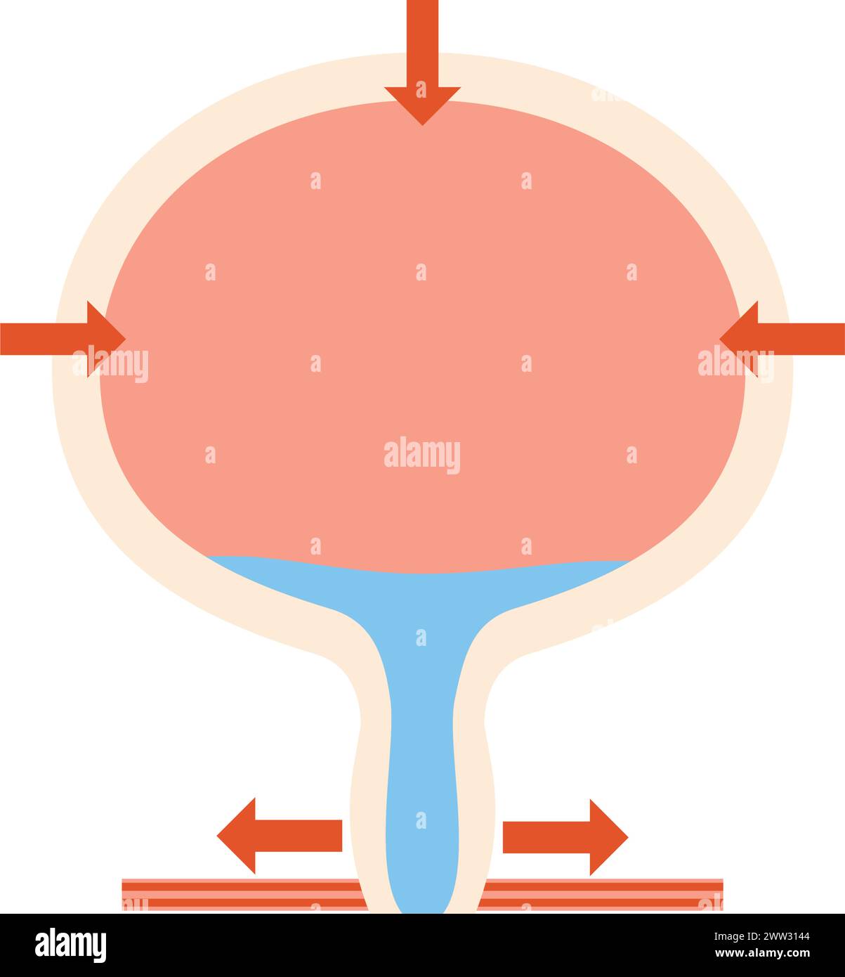 Medical illustration of the normal bladder, how it urinates, and how it ...