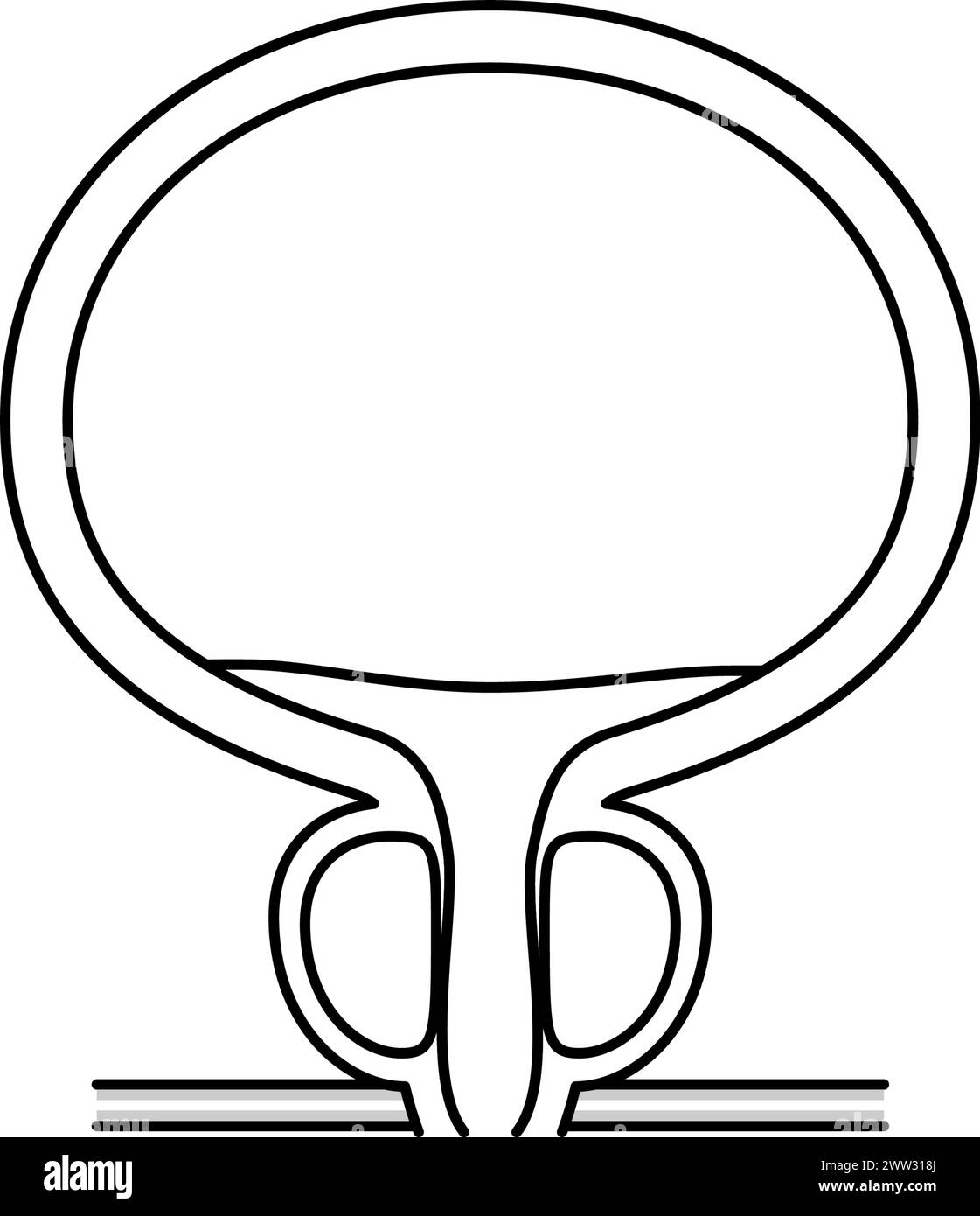 Medical illustration of benign prostatic hyperplasia, normal prostate ...
