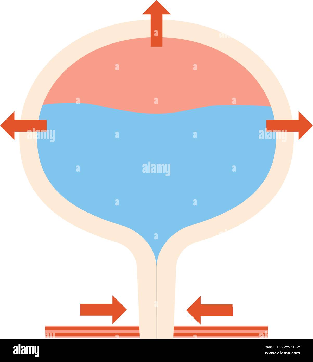 Medical illustration of the normal bladder, how it urinates, and how it ...