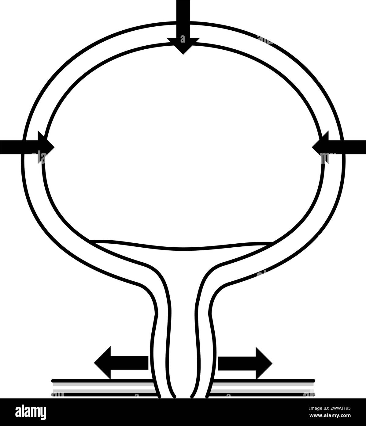 Medical illustration of the normal bladder, how it urinates, and how it ...