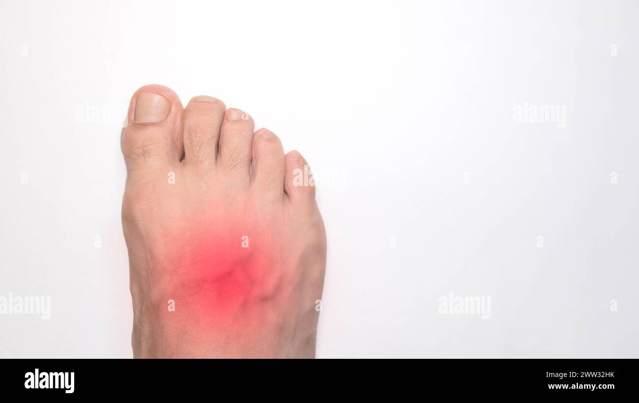 Podiatric examination hi-res stock photography and images - Alamy