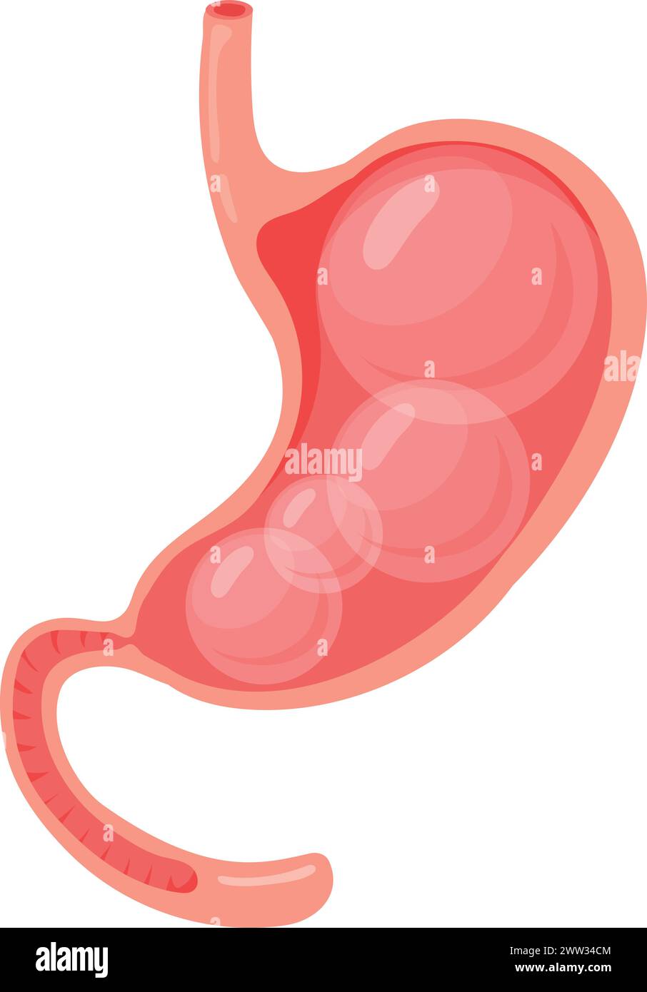 Bloating stomach cartoon icon. Digestive system problem isolated on ...