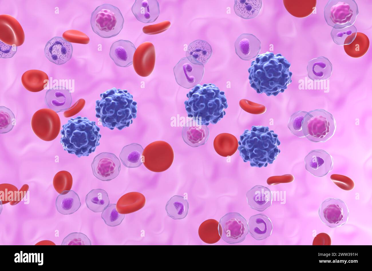 Erythema infectiosum hi-res stock photography and images - Alamy