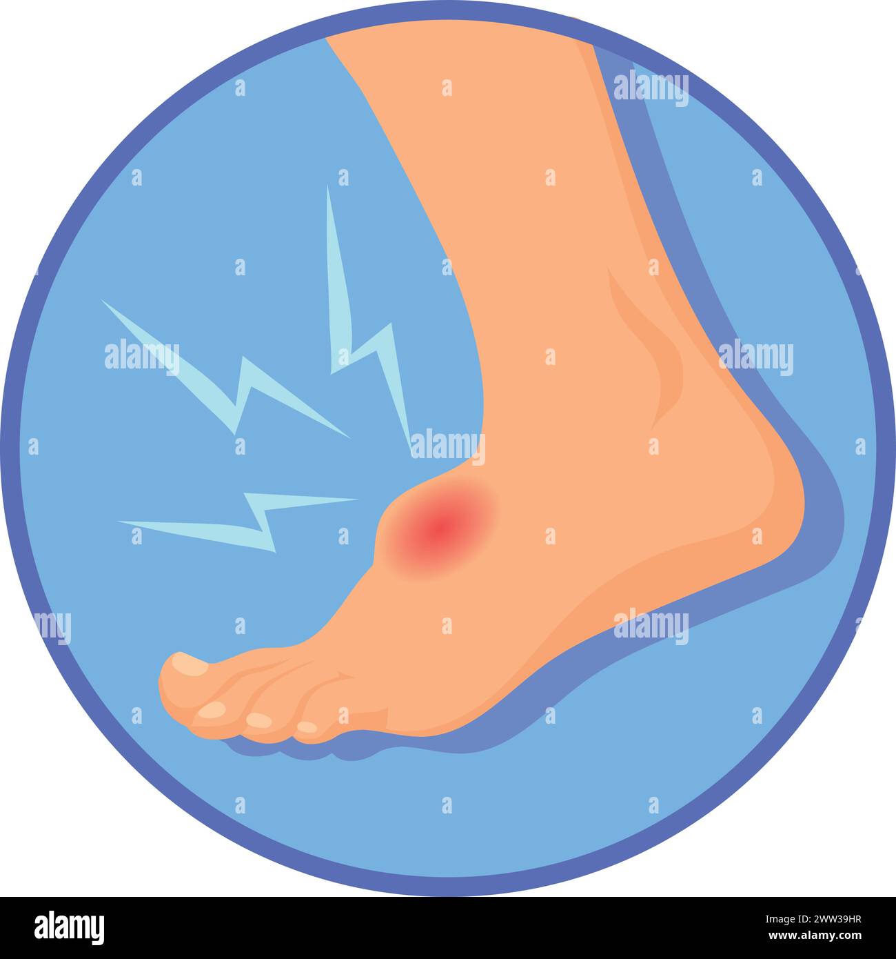 Foot hurt medical illustration. Pain spot icon isolated on white ...