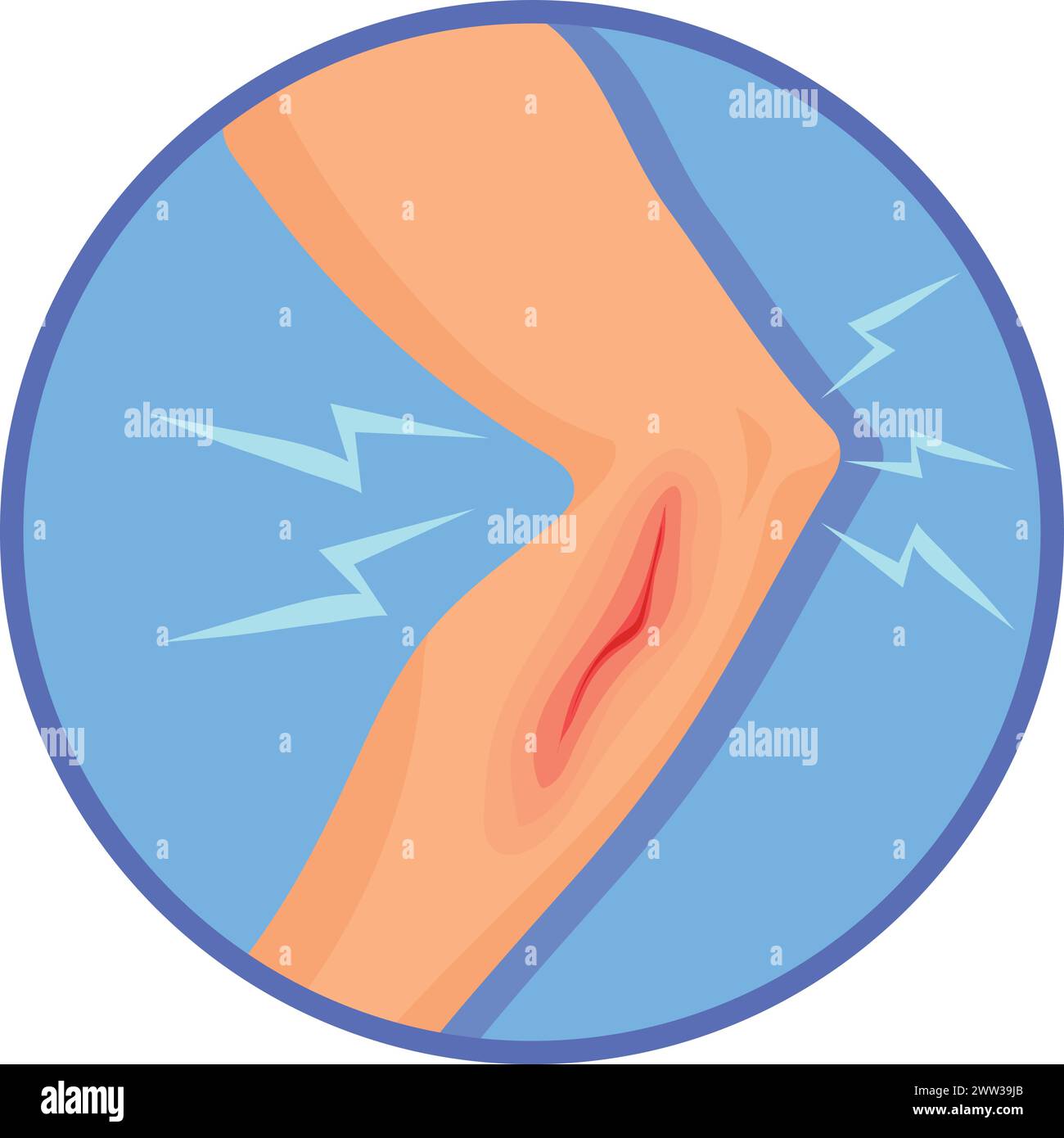 Human leg with bleeding wound. Medical injury illustration isolated on ...