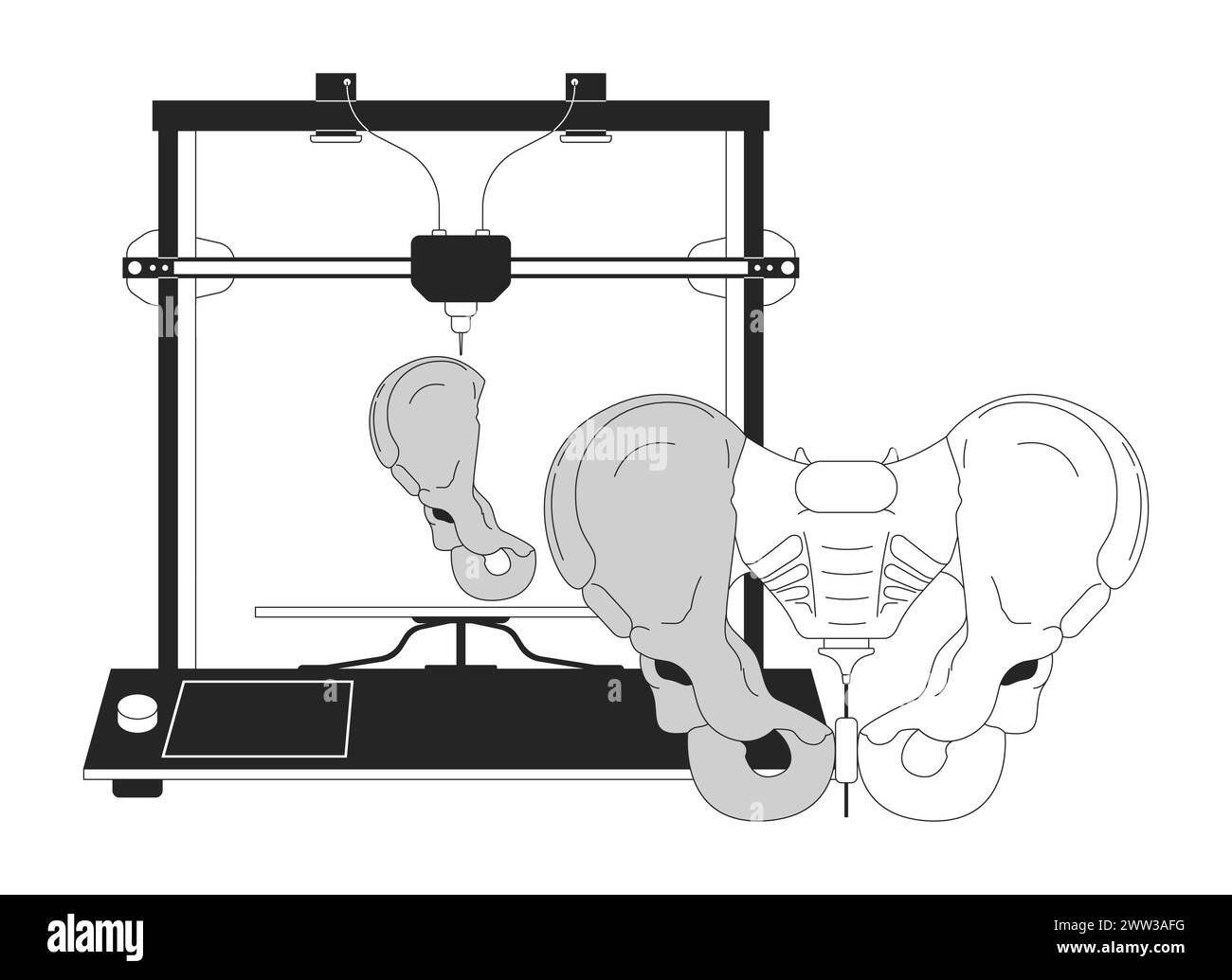 3D printing pelvis model black and white cartoon flat illustration ...