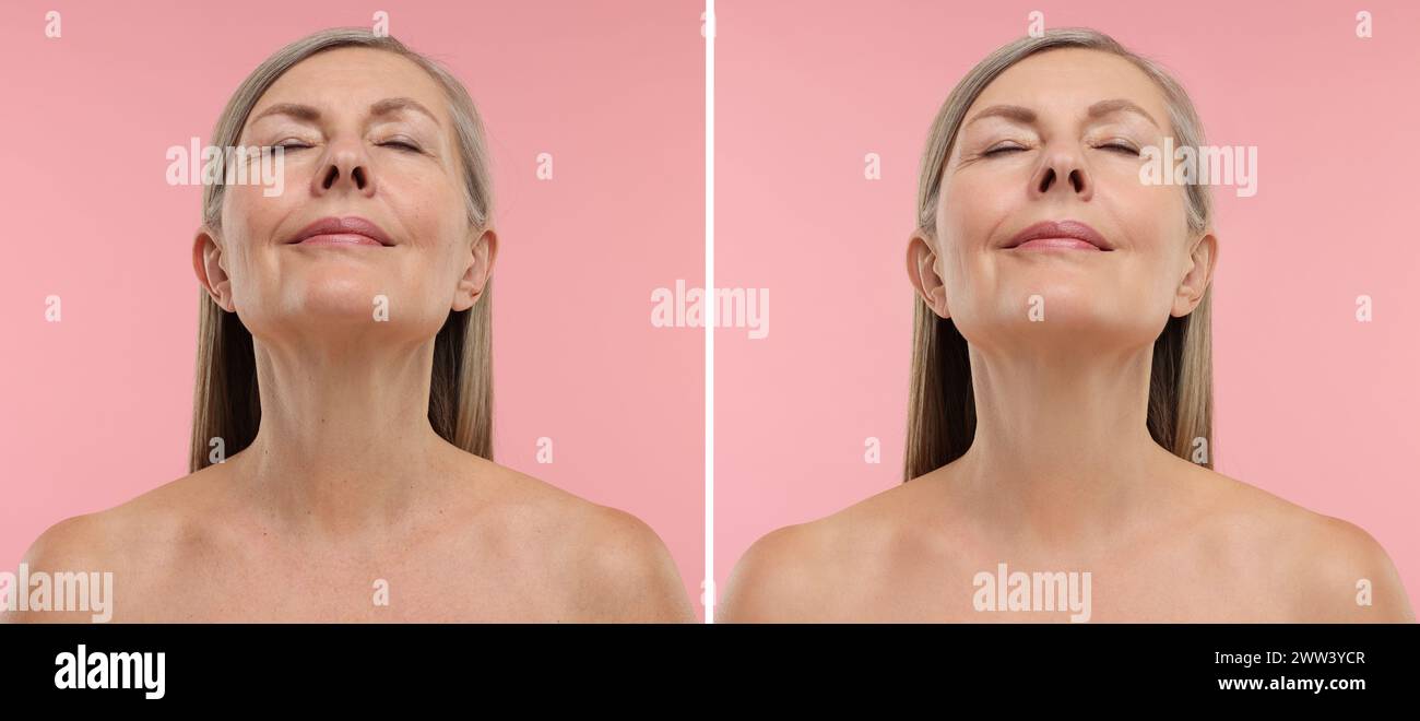 Aging skin changes. Collage with photos of mature woman before and ...