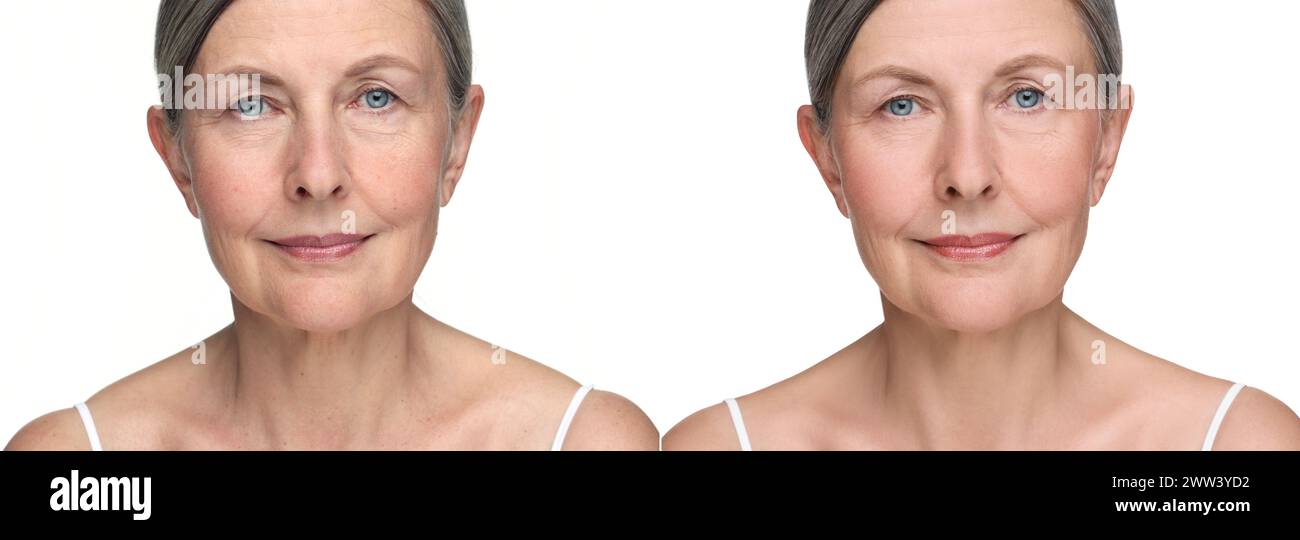 Aging skin changes. Collage with photos of mature woman before and ...