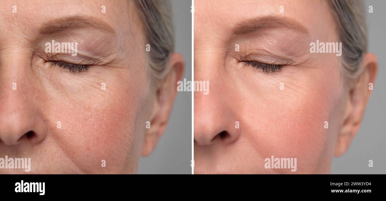 Aging skin changes. Collage with photos of mature woman before and ...