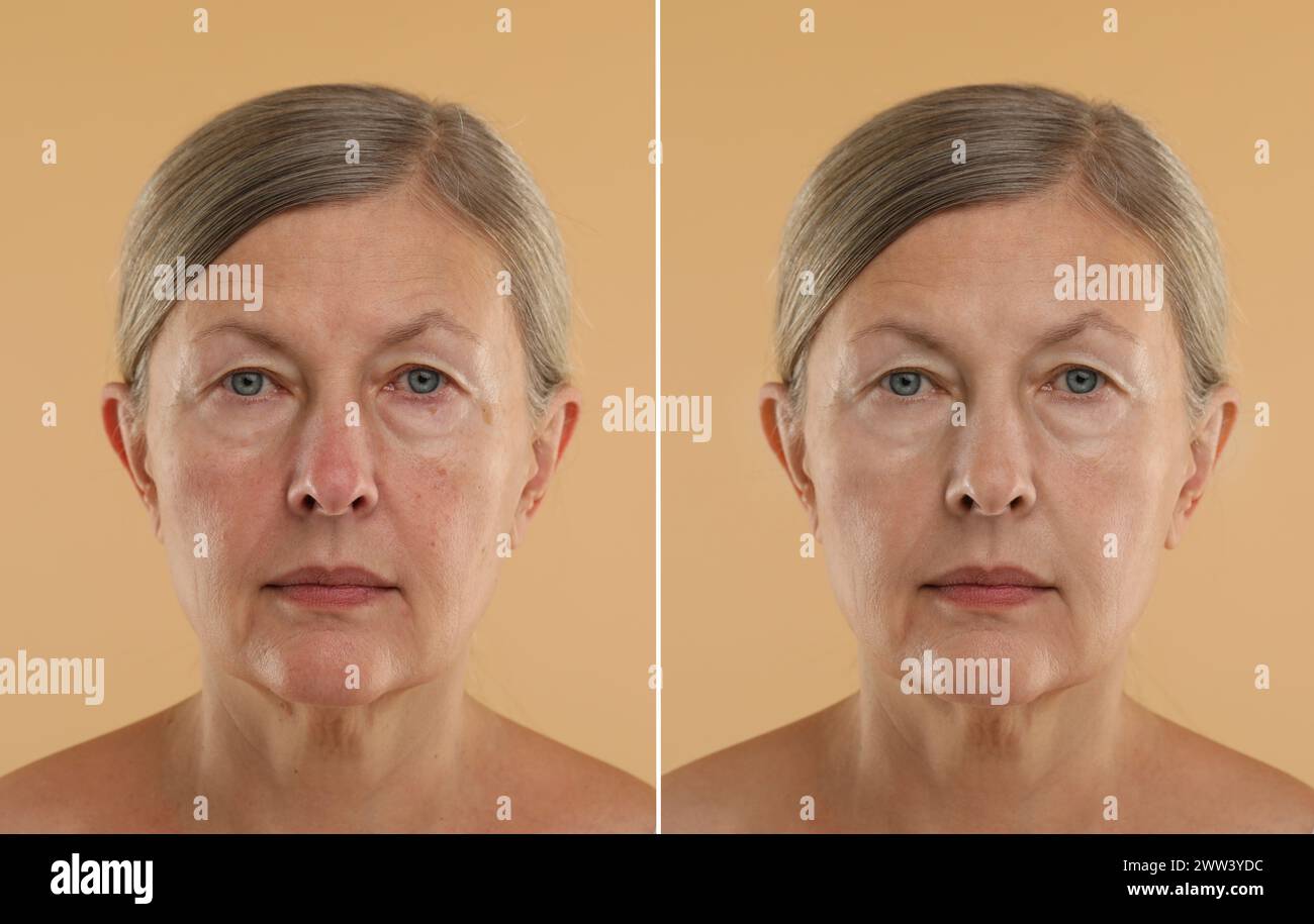 Aging skin changes. Collage with photos of mature woman before and ...