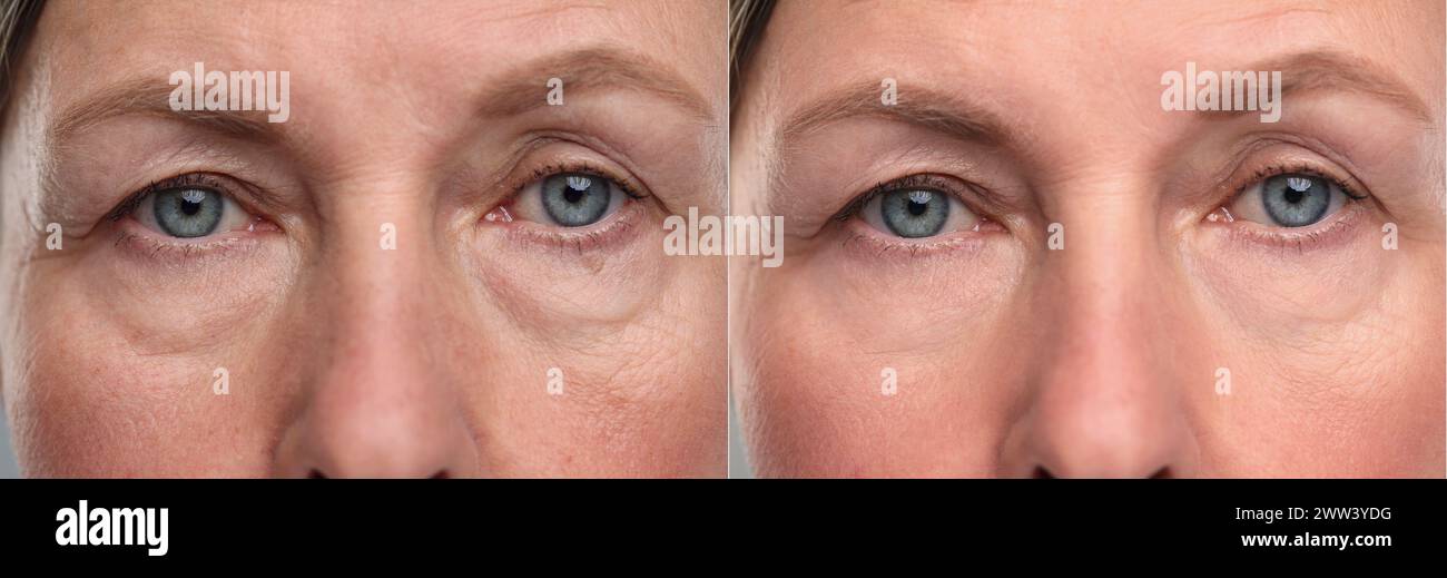 Aging skin changes. Collage with photos of mature woman before and ...