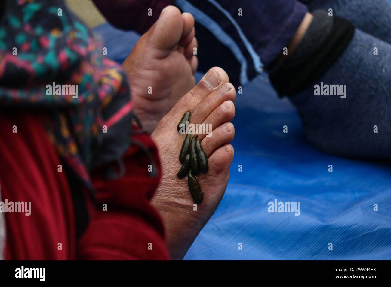 Patient receive blood hi-res stock photography and images - Alamy