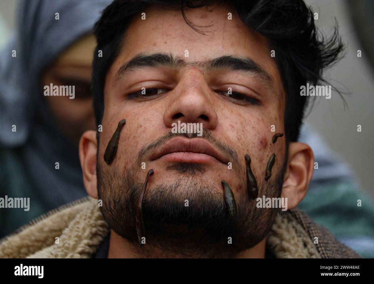 Non Exclusive: March 21,2024, Srinagar, India: A man’s face seen with ...